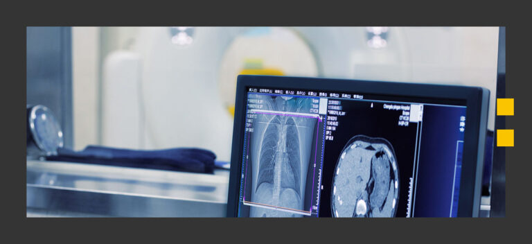 Understanding Myocardial Viability PET Scans: What to Know