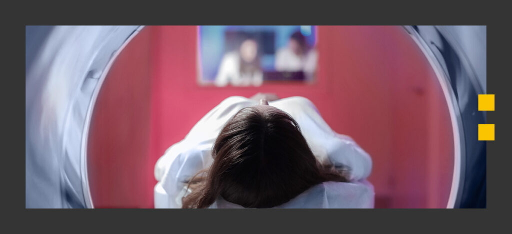 Understanding SPECT Scans for Mental Health Conditions