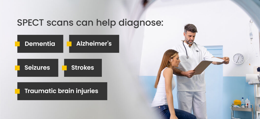 Understanding SPECT Scans for Mental Health Conditions